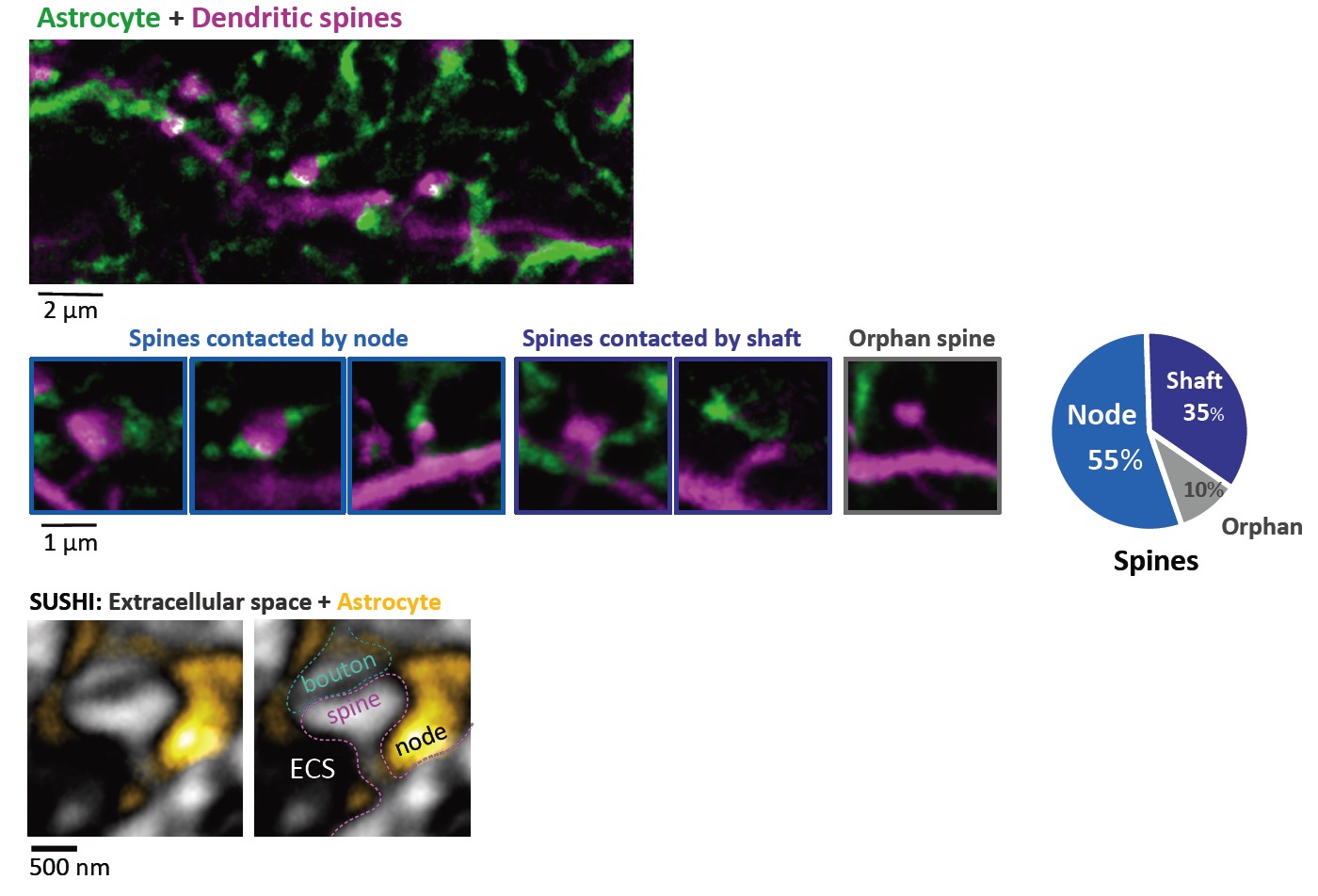 3D-STED Super-Resolution Microscopy Unravels the Mystery of Astrocytes ...