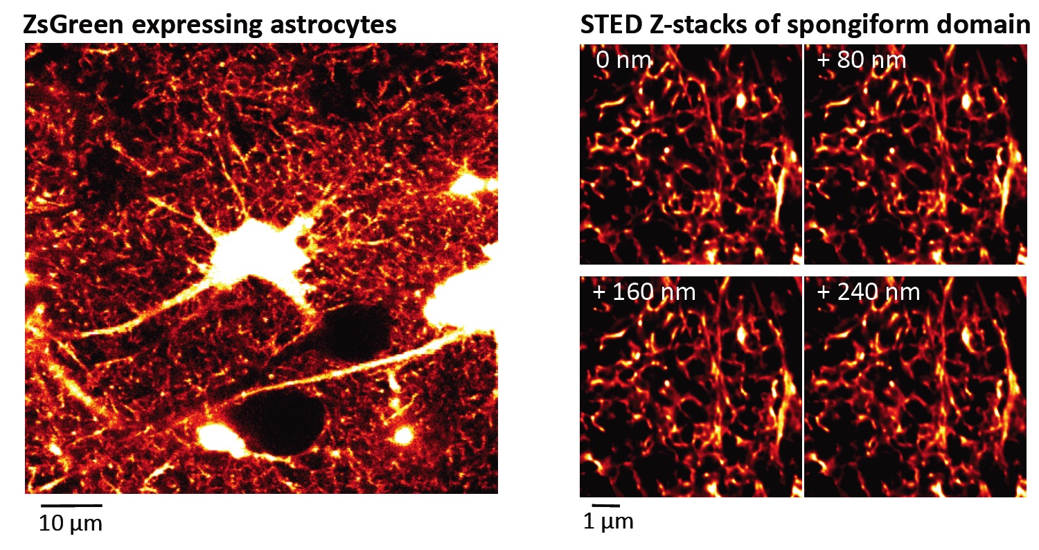 3D-STED Super-Resolution Microscopy Unravels the Mystery of Astrocytes ...