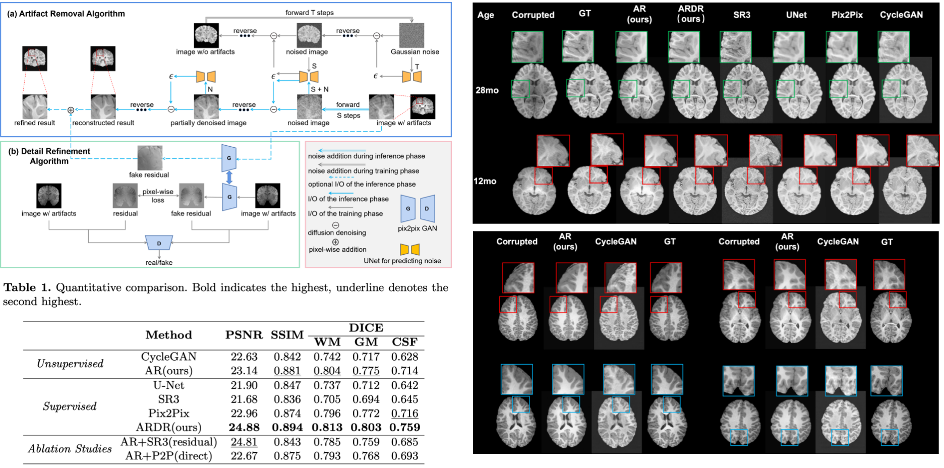 Numerous abstracts from BME accepted for ISMRM 2025 Annual Meeting