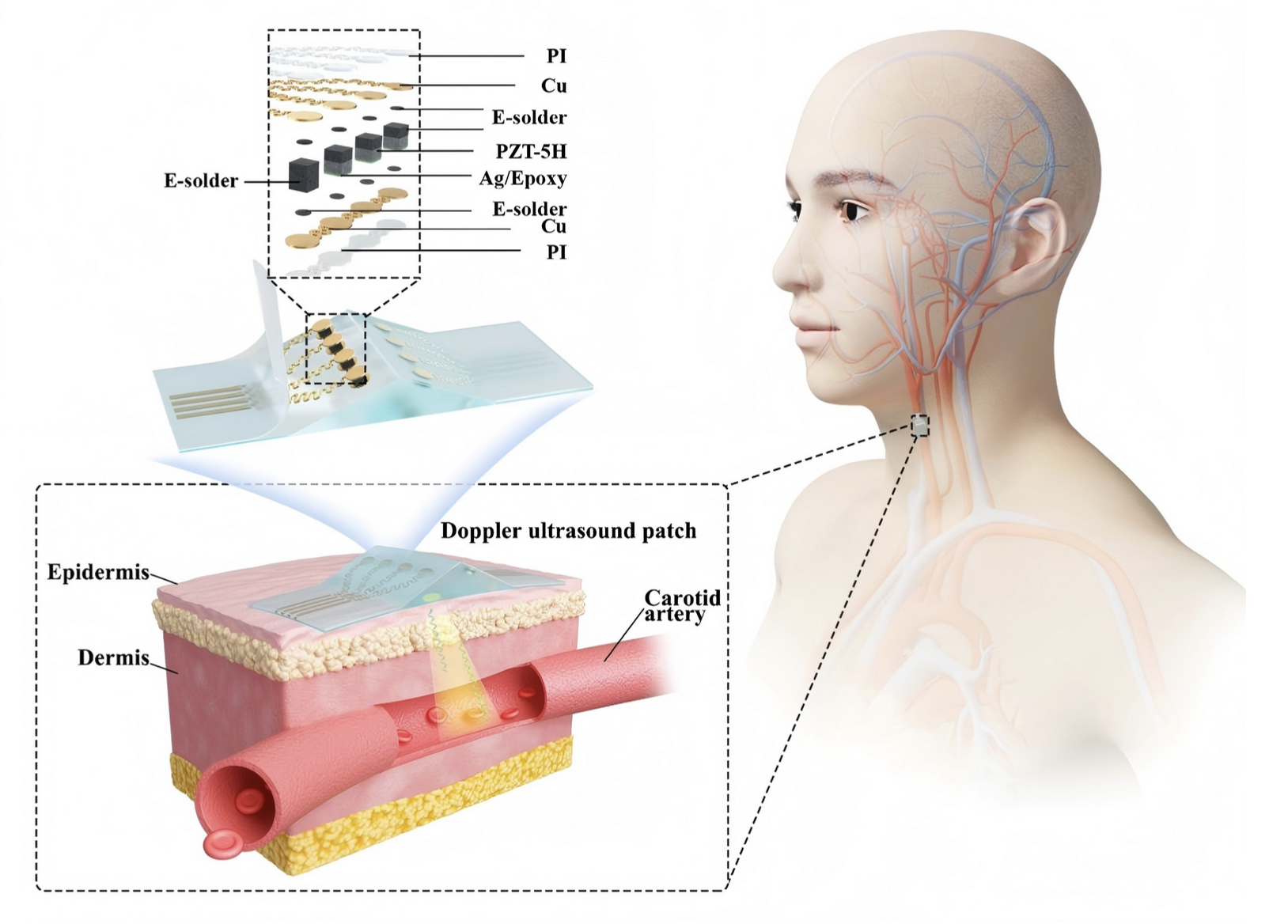 BME team develops stretchable Doppler ultrasound patch for continuous ...